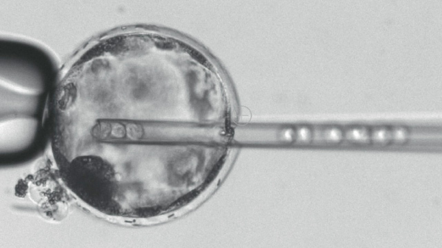 Scientists create first human-pig embryos Scientists create first human-pig embryos